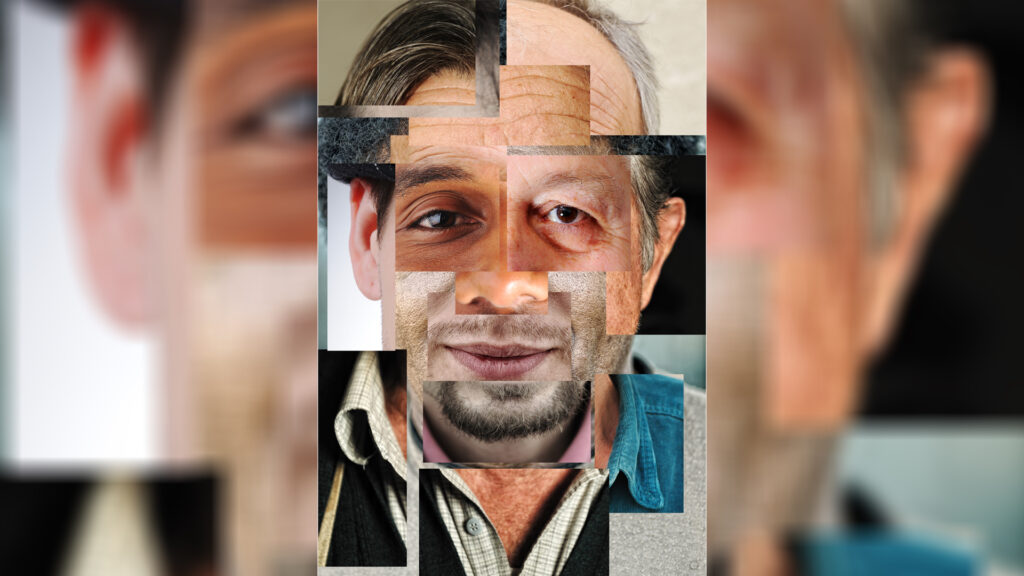 Society Must Evolve Now and Accept Unique Facial Differences - Fair ...